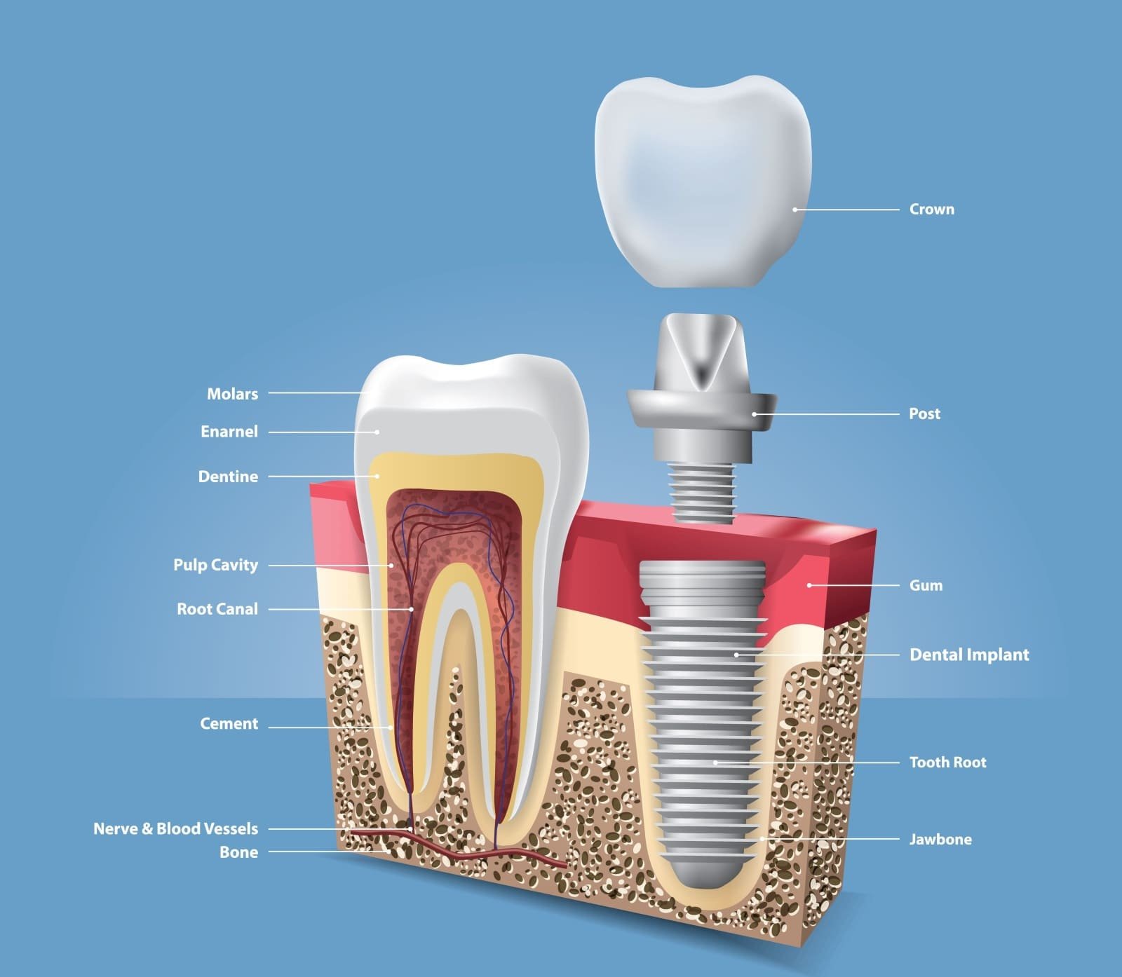 Best dental hospital in visakhapatnam | Dentie MultiSpecialty Dental ...